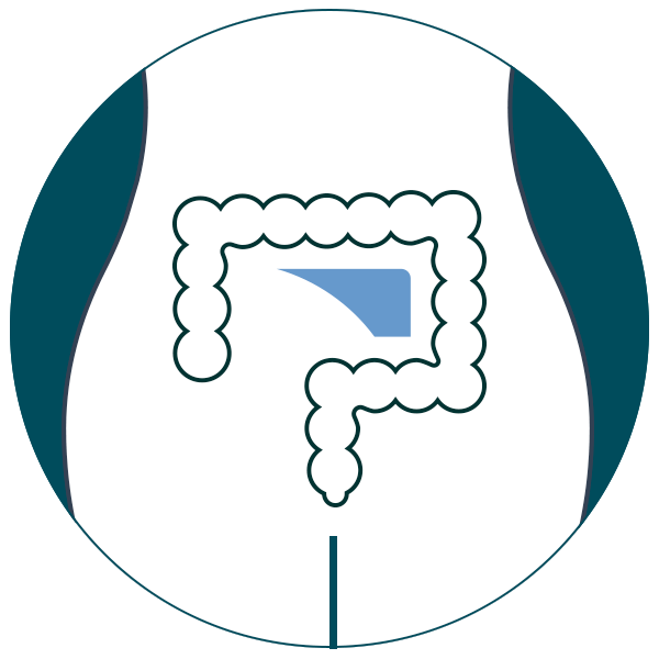Colonoscopy - Peninsula Gastroenterology