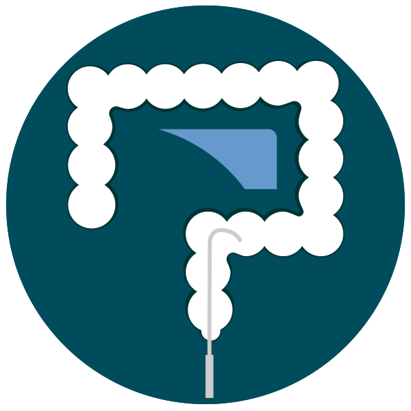 Flexible Sigmoidoscopy - Peninsula Gastroenterology